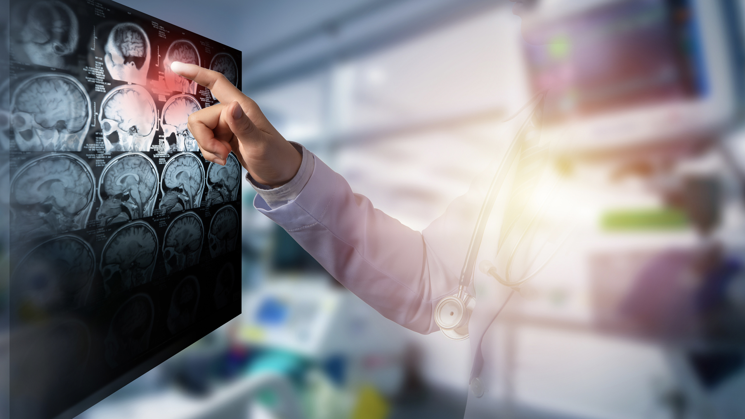 After a Stroke: What to Expect and How to Begin Your Recovery